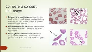 Peripheral blood smear 2020 | PPTX