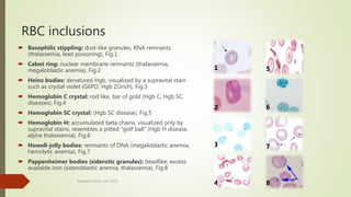 Peripheral blood smear 2020 | PPTX