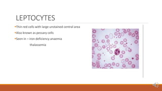 Peripheral blood smear [autosaved] | PPTX