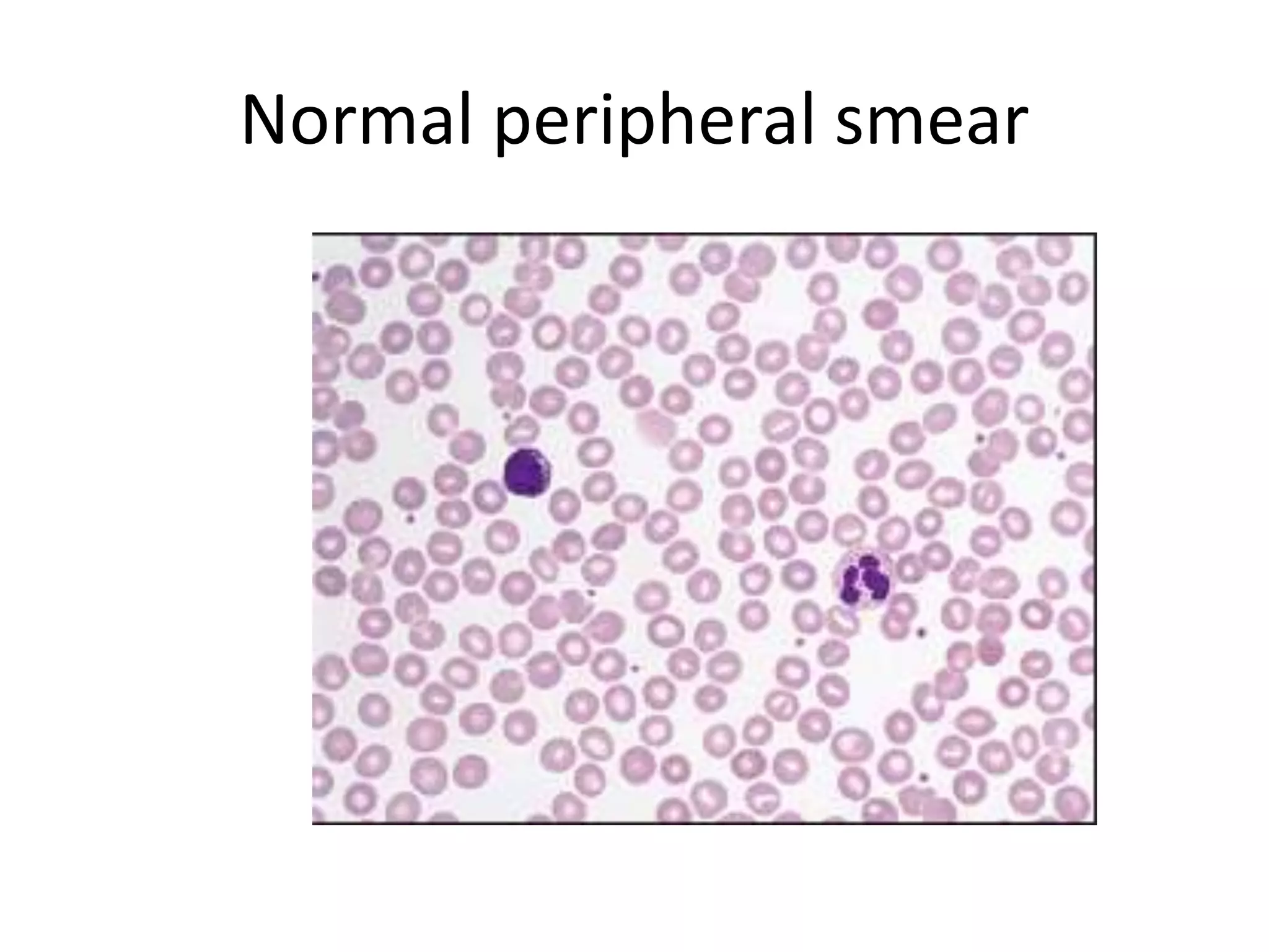 Peripheral blood smear examination | PPTX