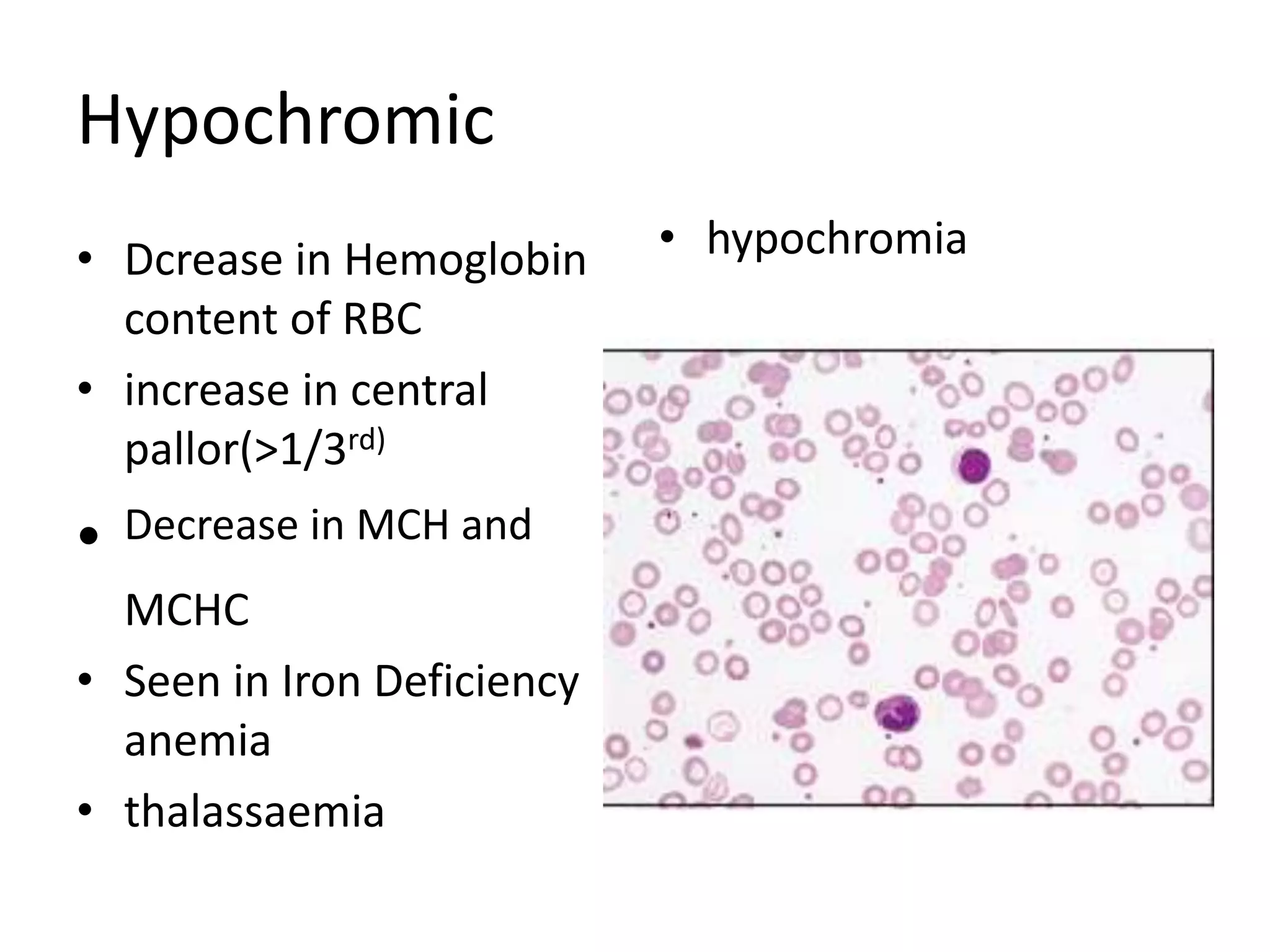 Peripheral blood smear examination | PPTX