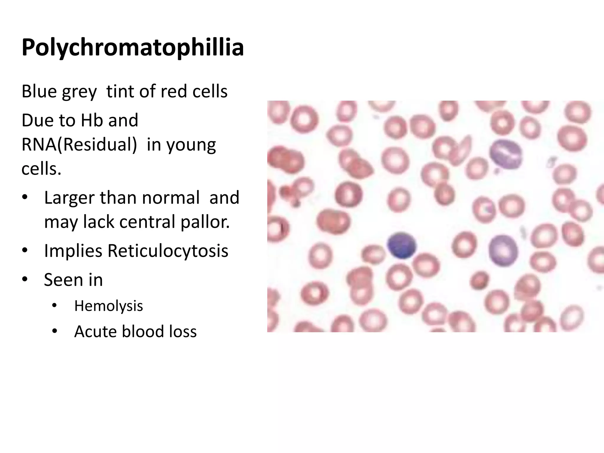 Peripheral blood smear examination | PPTX