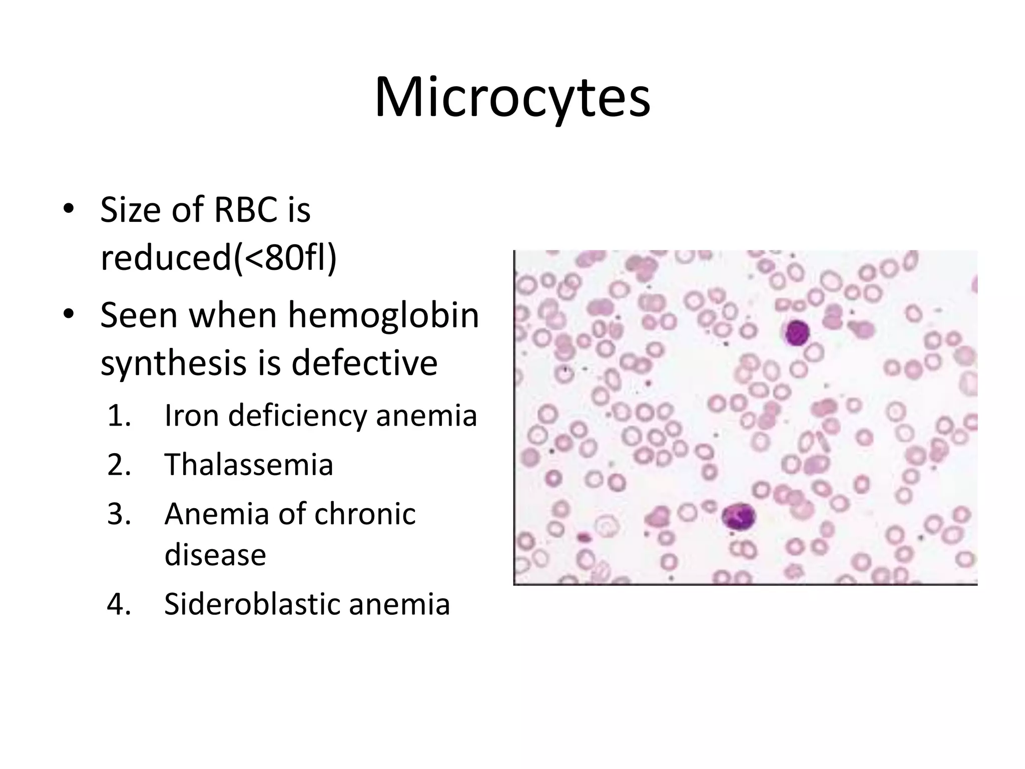 Peripheral blood smear examination | PPTX