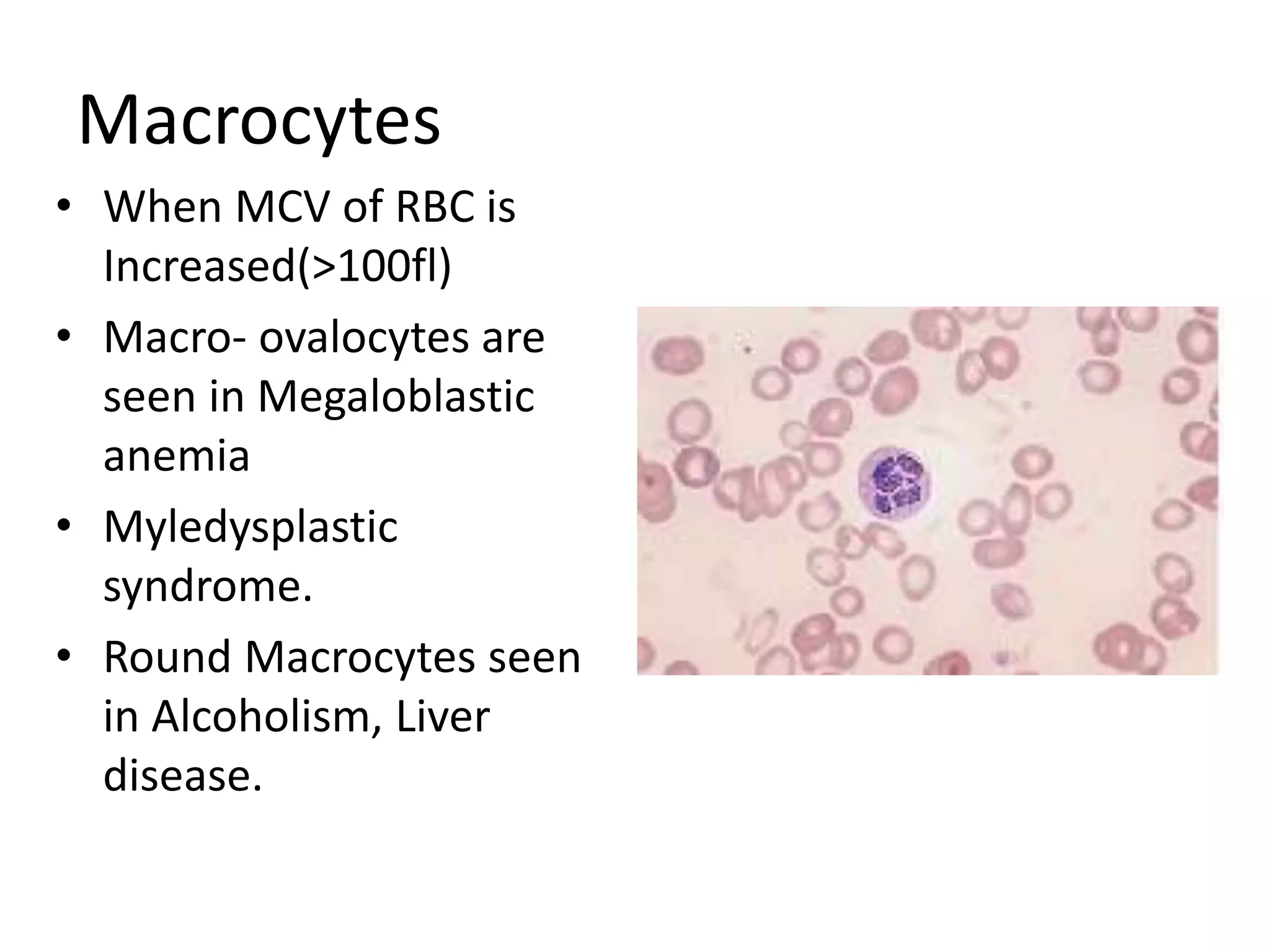 Peripheral blood smear examination | PPTX
