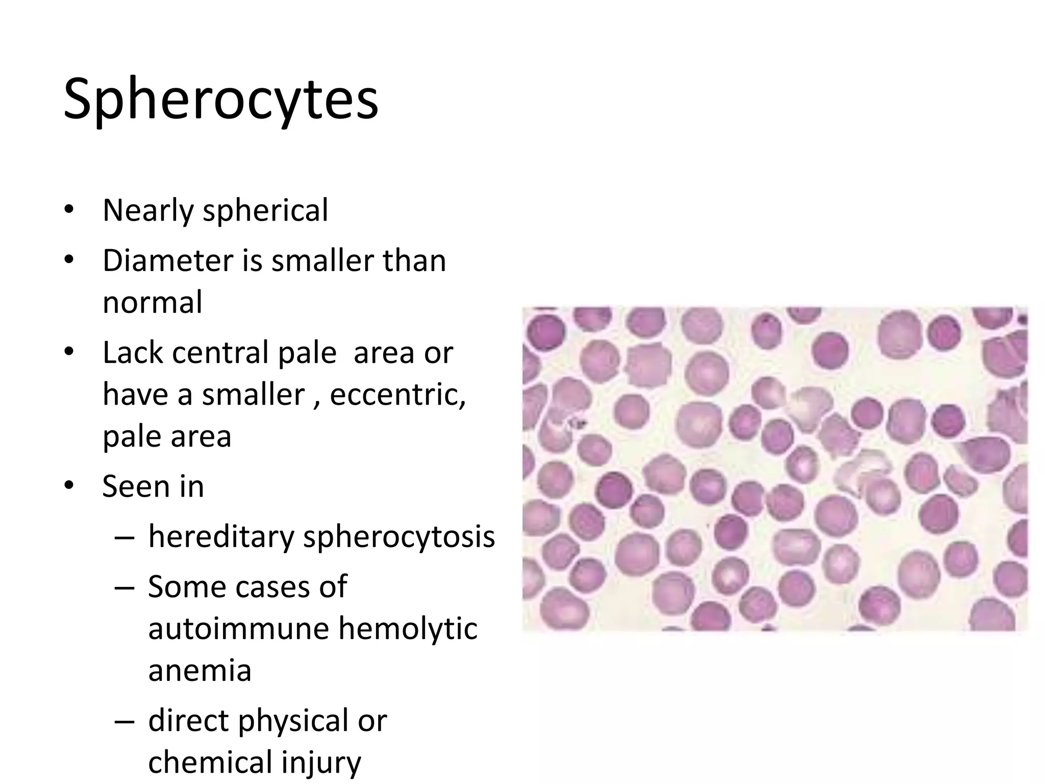 Peripheral blood smear examination | PPTX