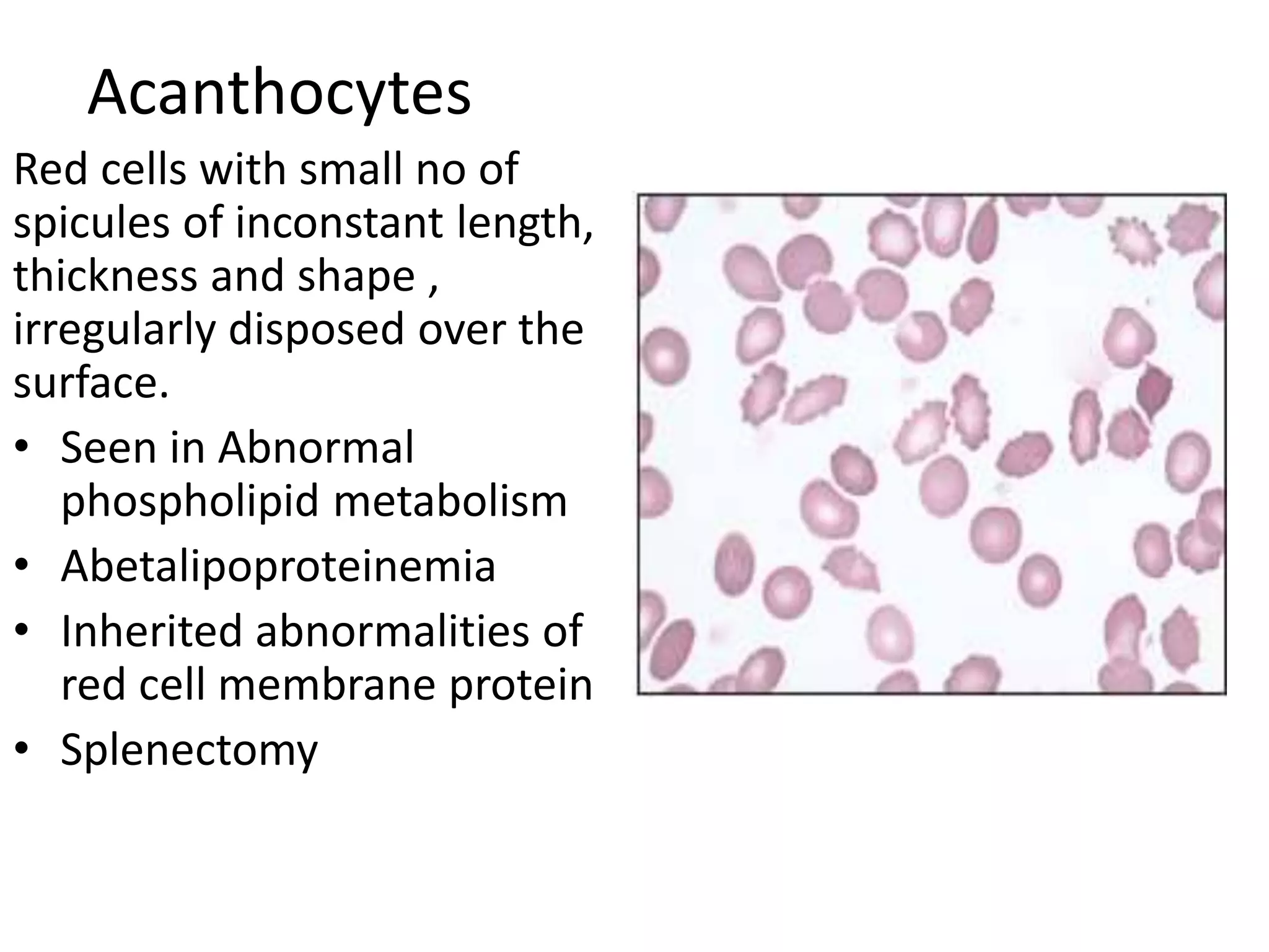 Peripheral blood smear examination | PPTX