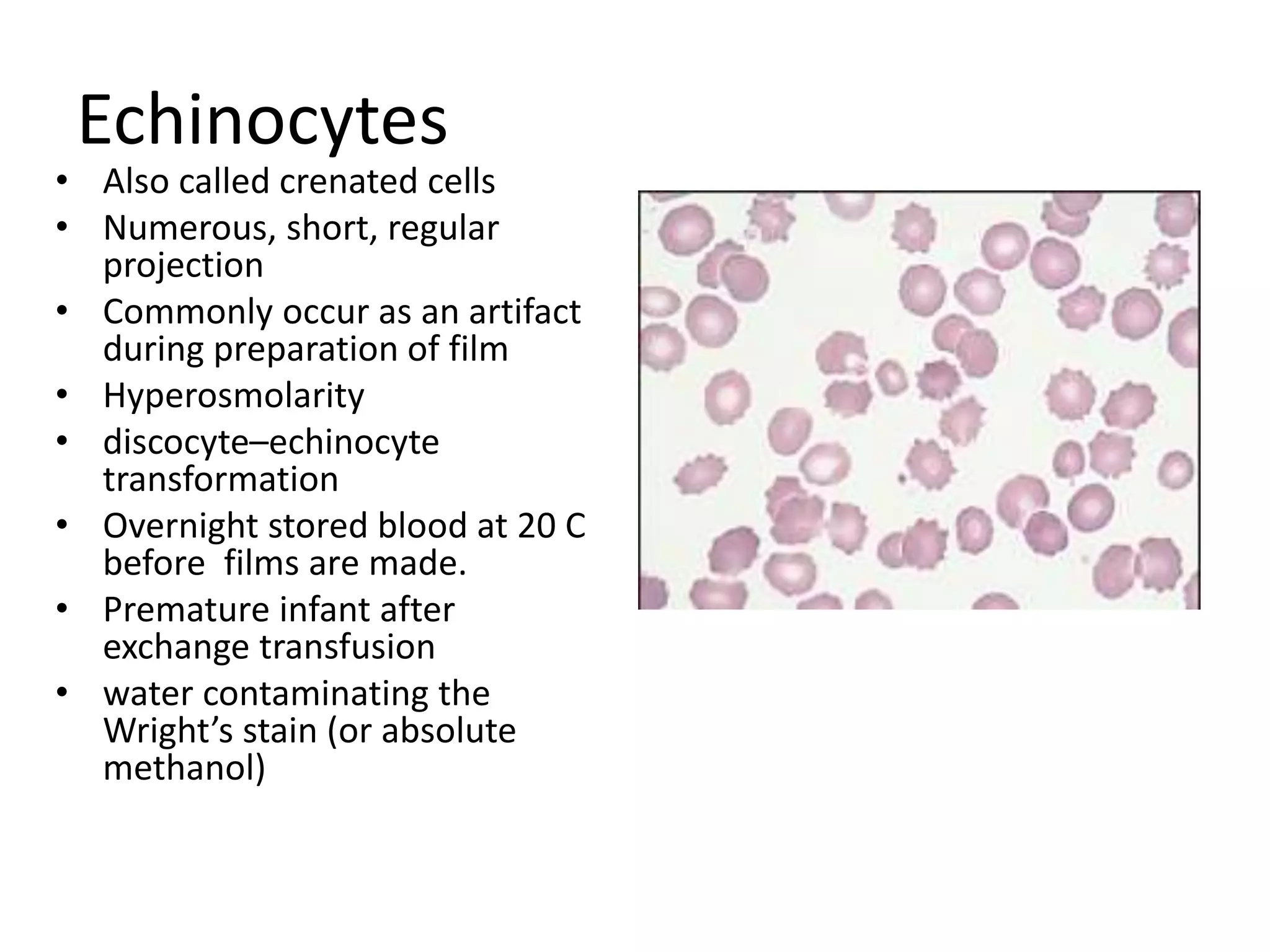 Peripheral blood smear examination | PPTX