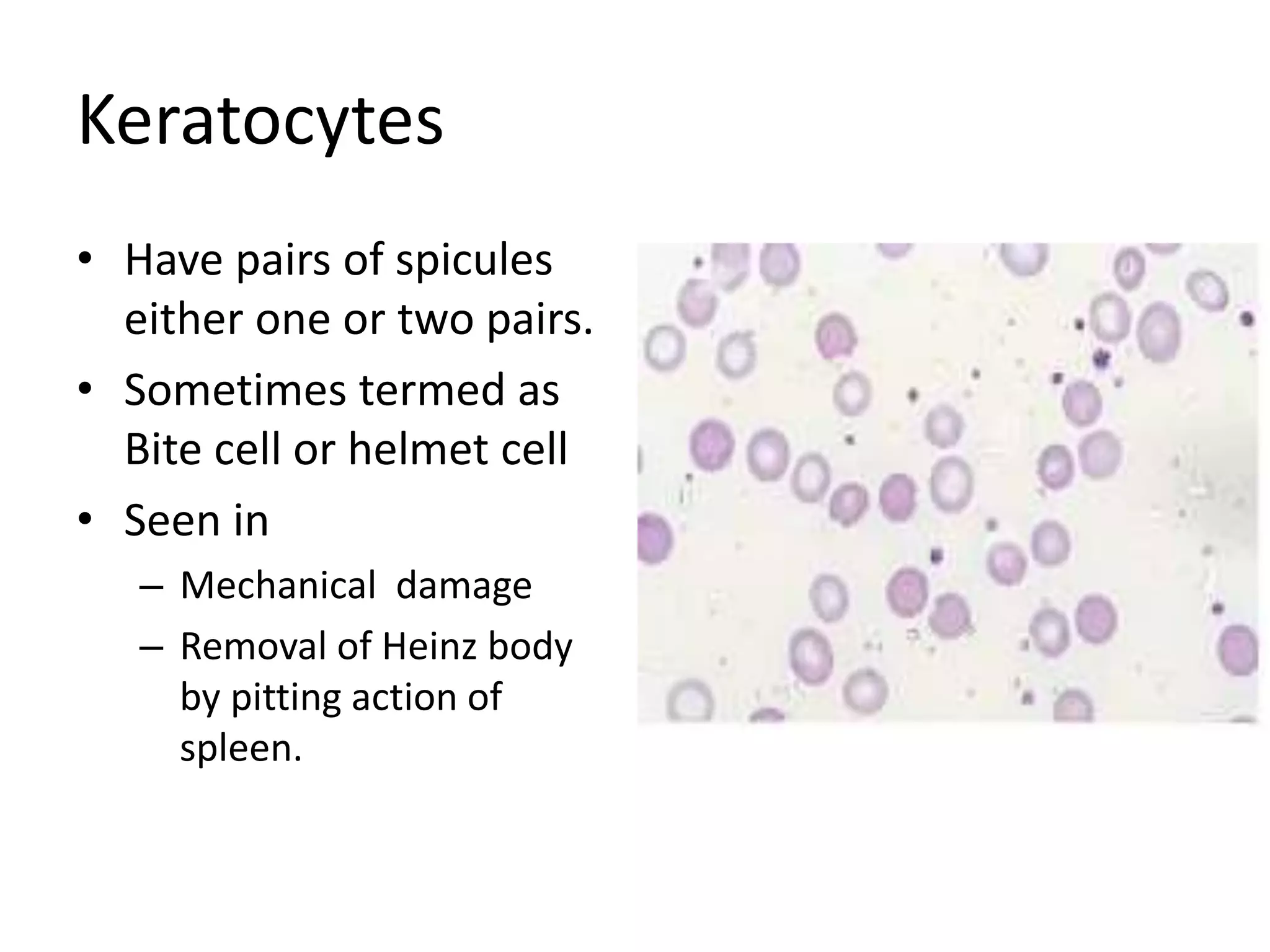 Peripheral blood smear examination | PPTX