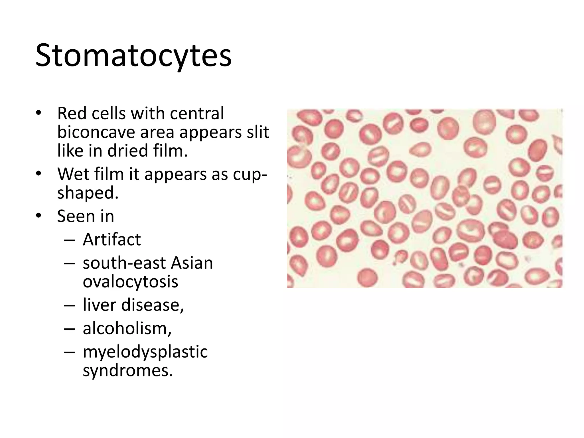 Peripheral blood smear examination | PPTX