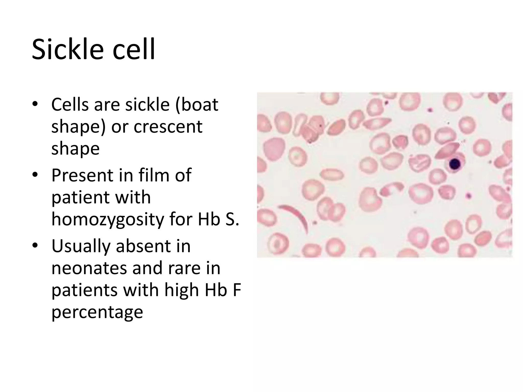 Peripheral blood smear examination | PPTX