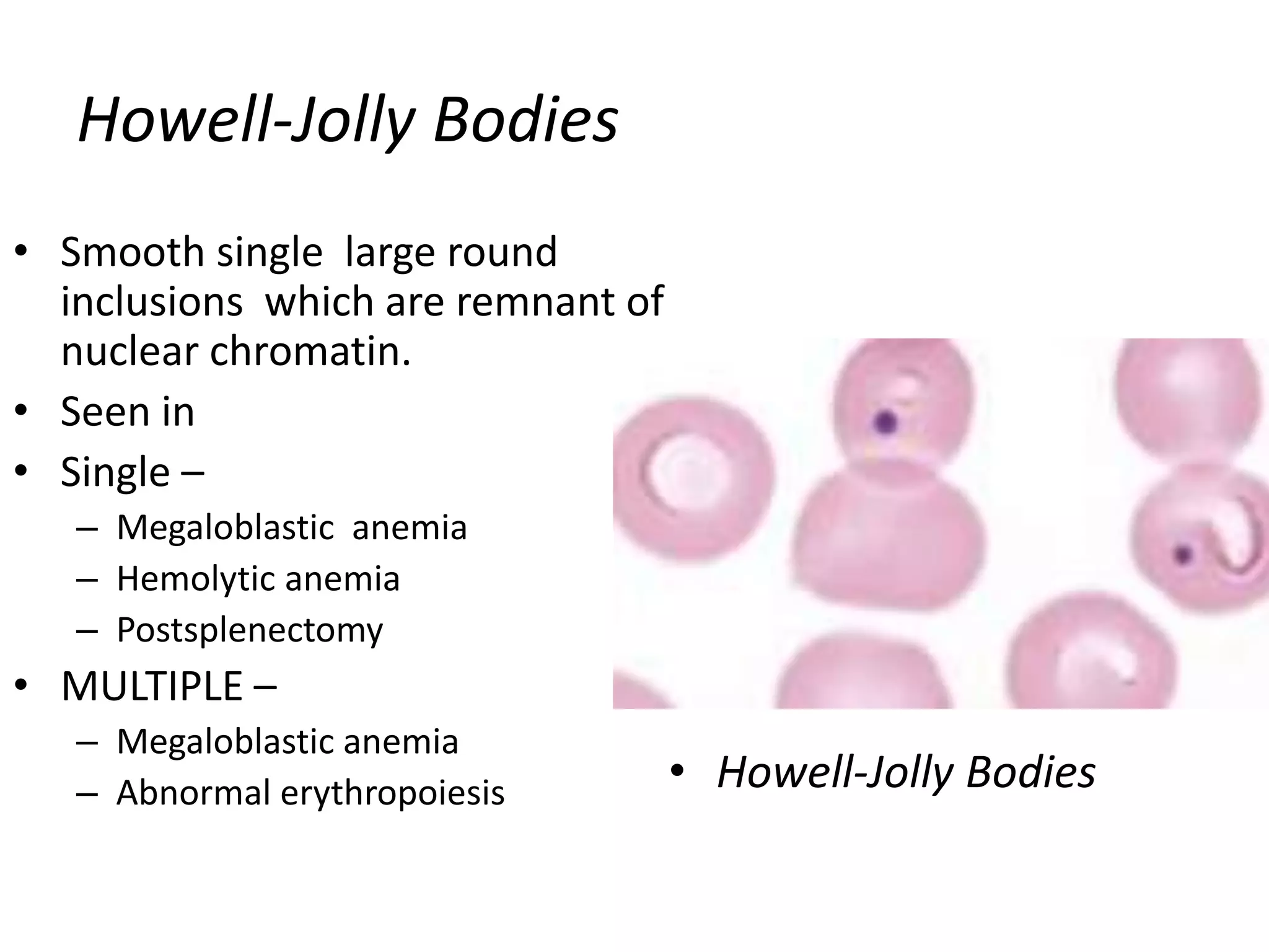 Peripheral blood smear examination | PPTX