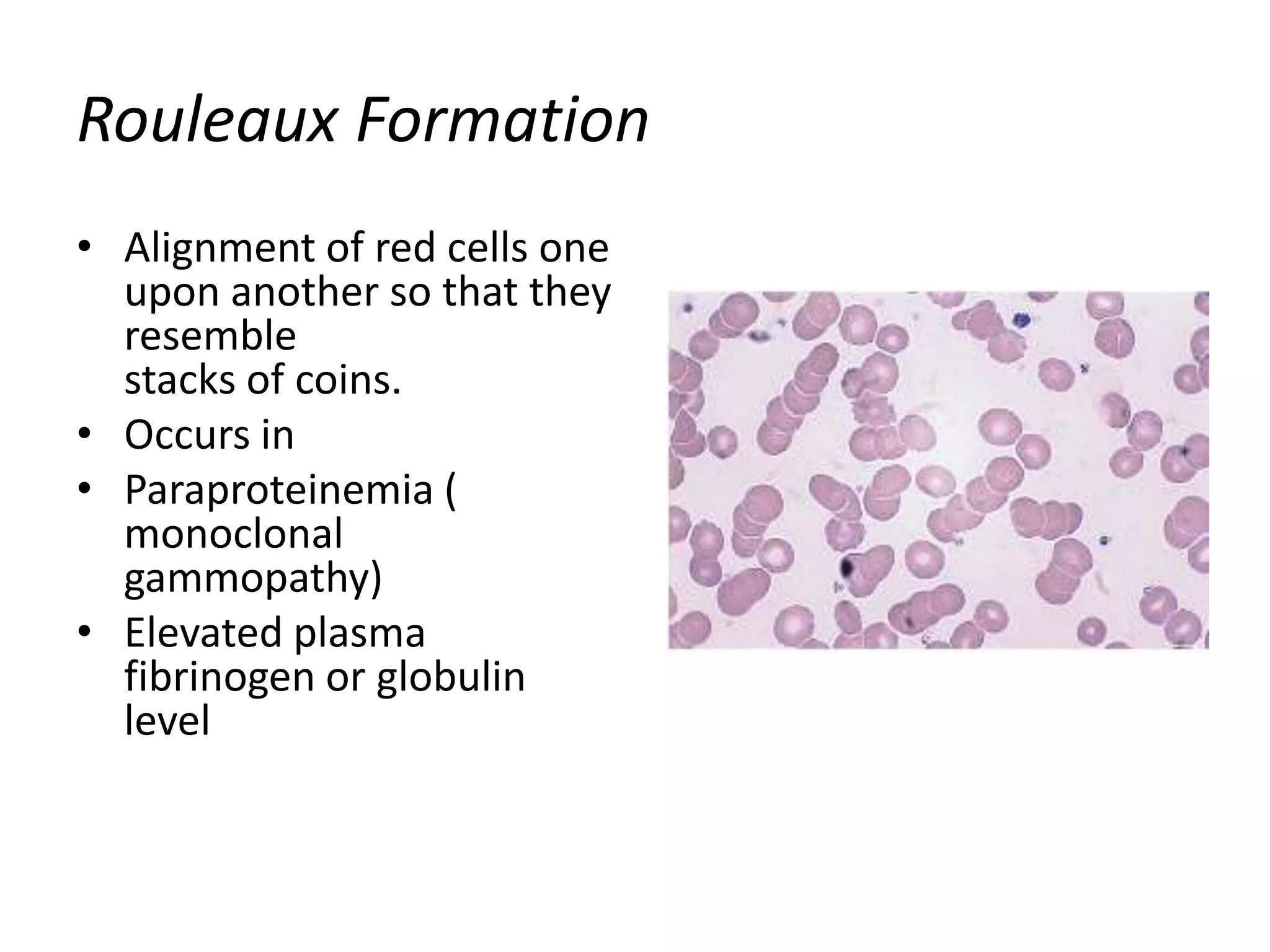 Peripheral blood smear examination | PPTX