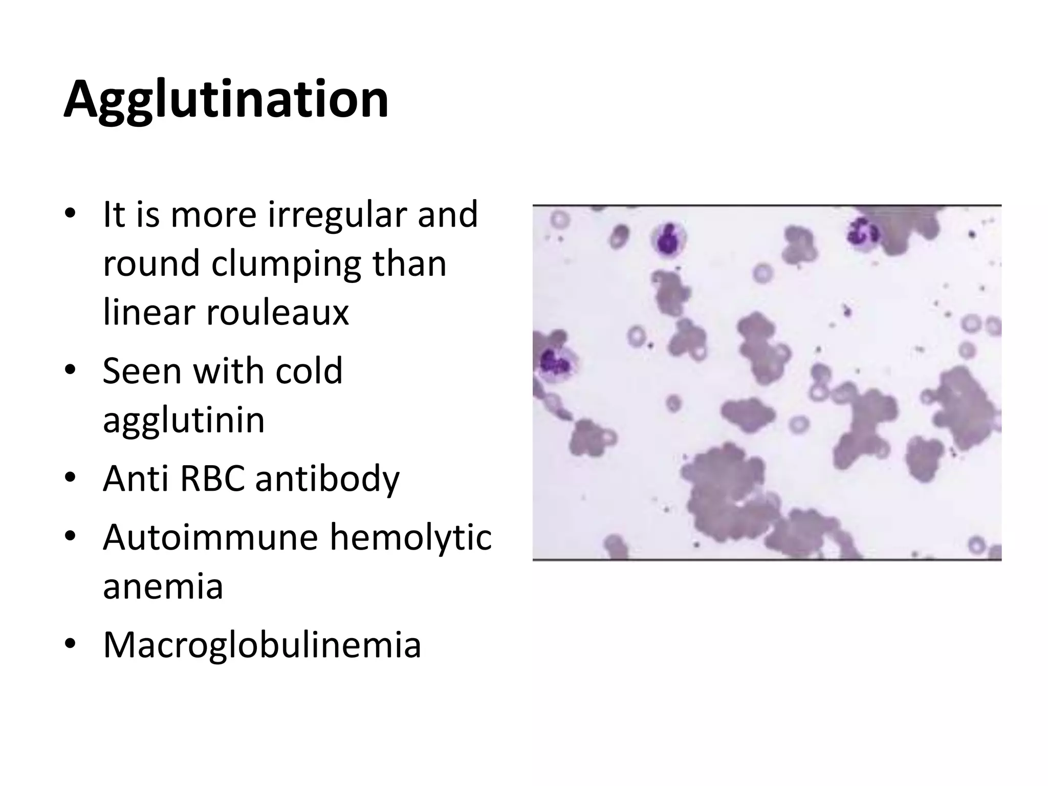 Peripheral blood smear examination | PPTX