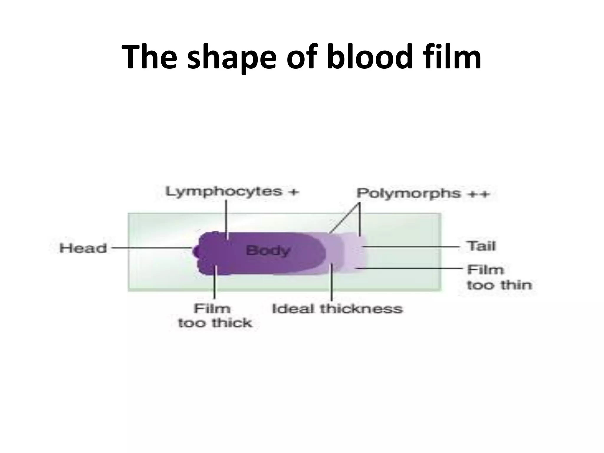 Peripheral blood smear examination | PPTX | Blood Disorders | Diseases ...