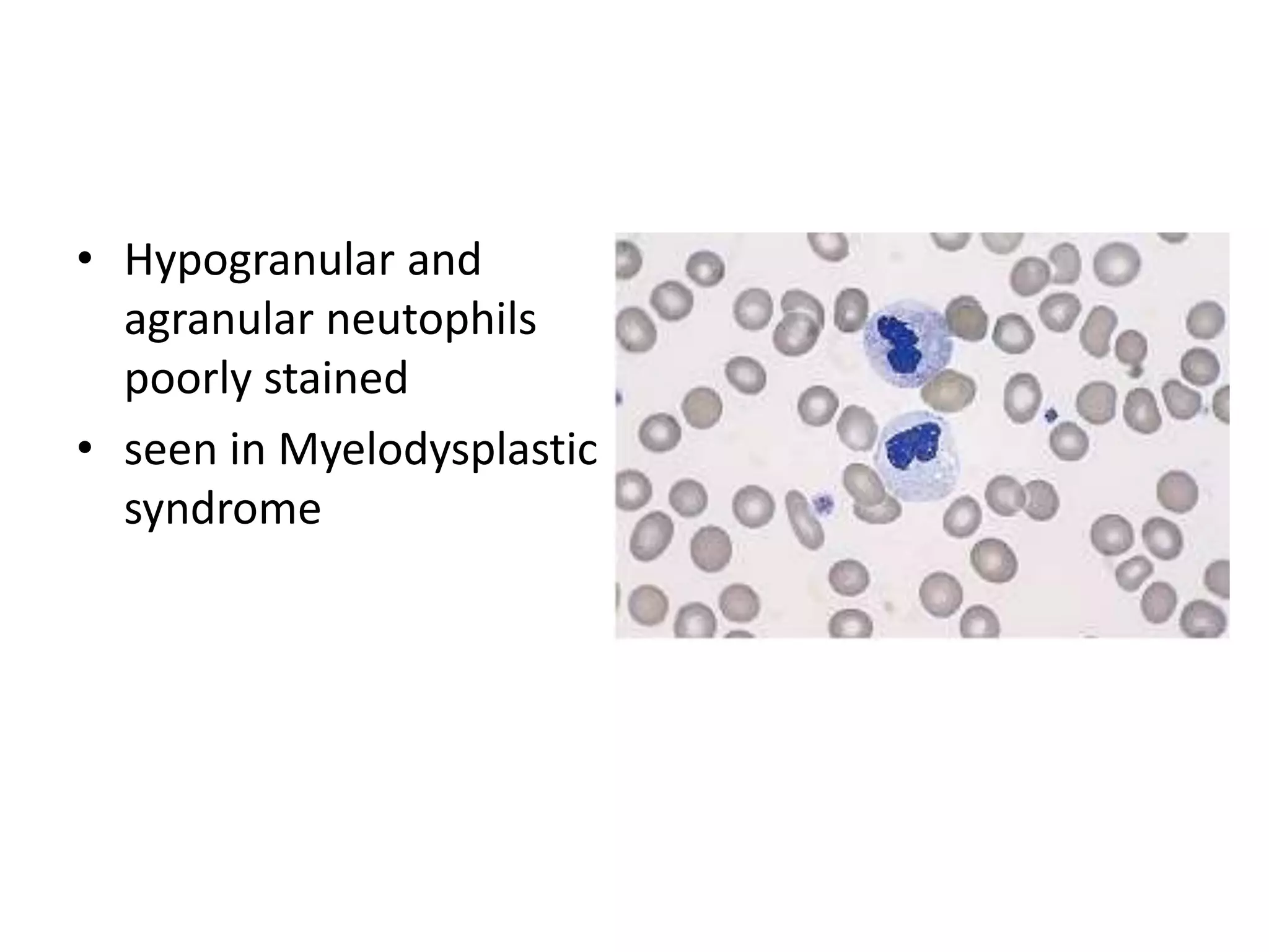 Peripheral blood smear examination | PPTX