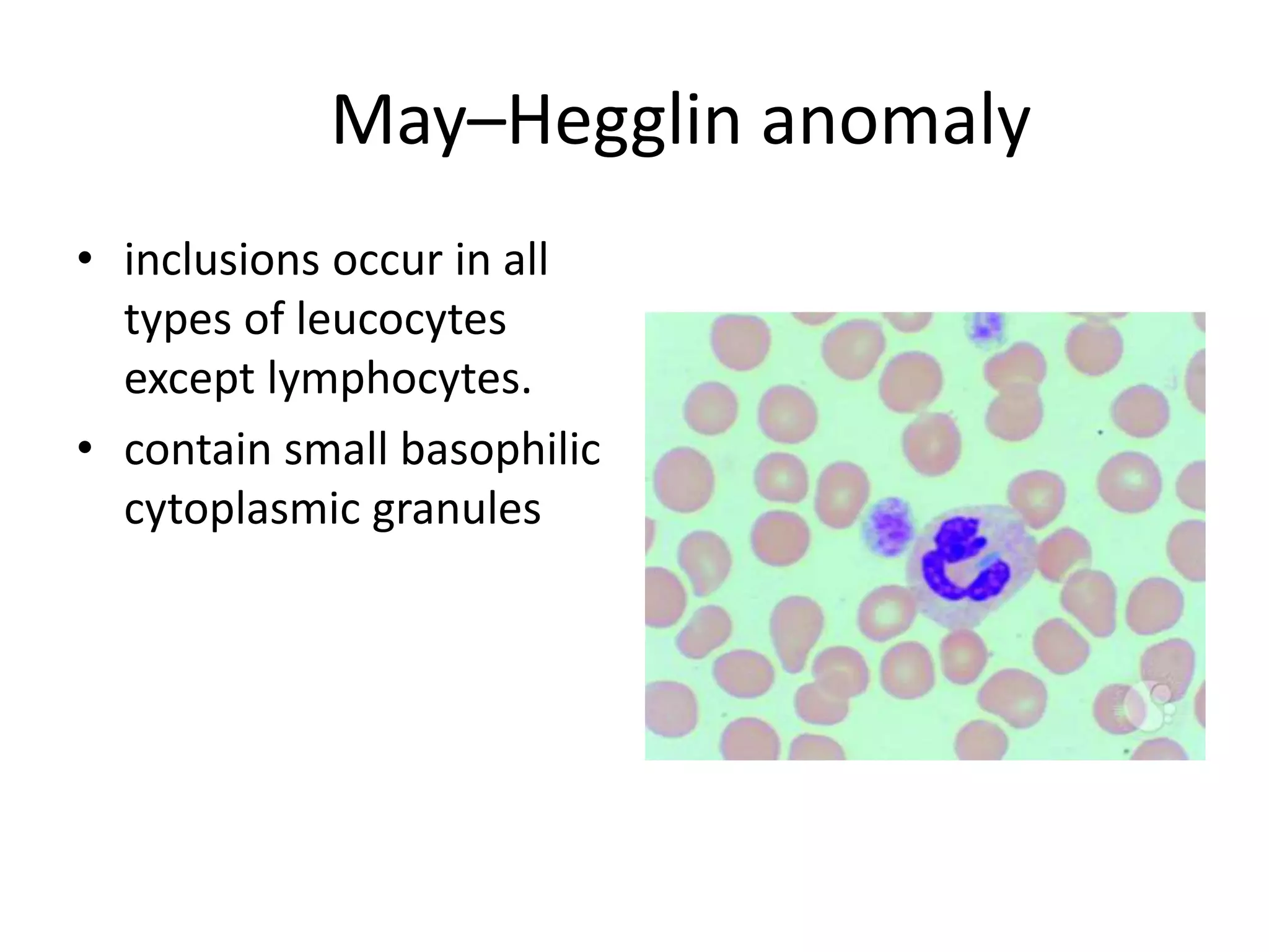 Peripheral blood smear examination | PPTX