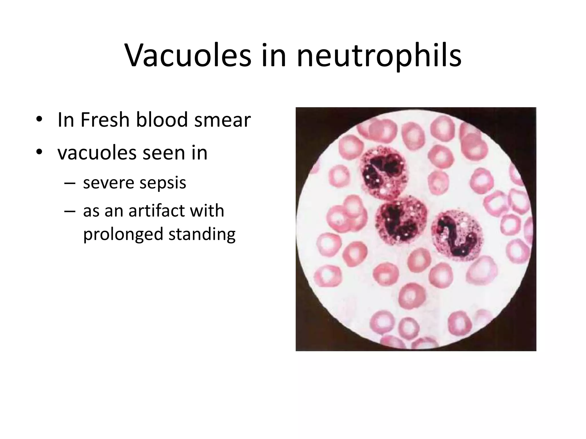 Peripheral blood smear examination | PPTX
