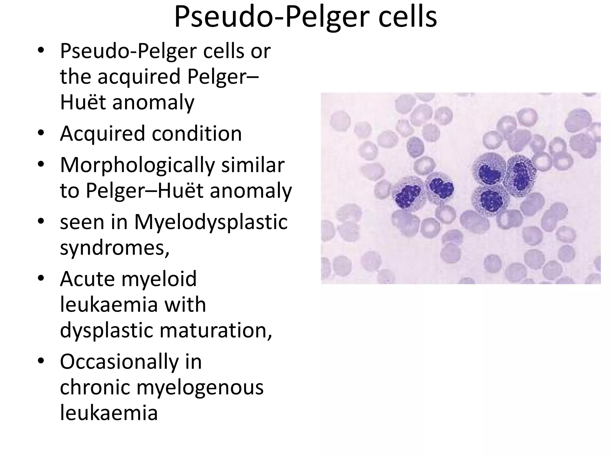 Peripheral blood smear examination | PPTX
