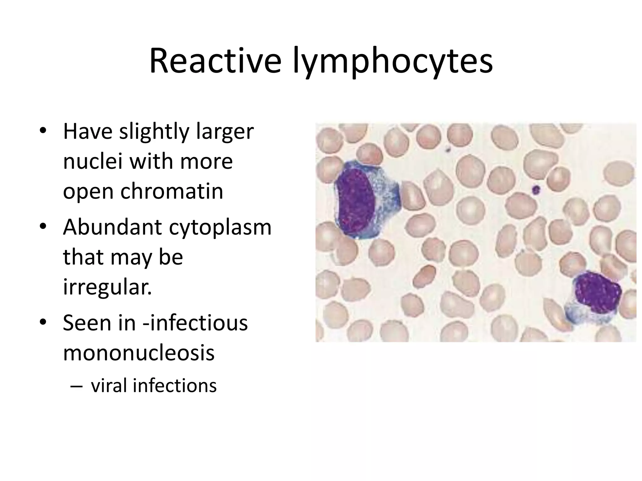 Peripheral blood smear examination | PPTX