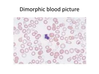 Peripheral blood smear examination | PPTX