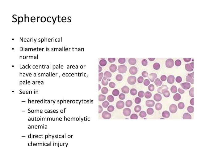 Peripheral blood smear examination | PPTX | Blood Disorders | Diseases ...