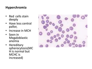 Peripheral blood smear examination | PPT