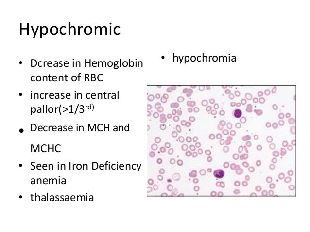 Peripheral blood smear examination