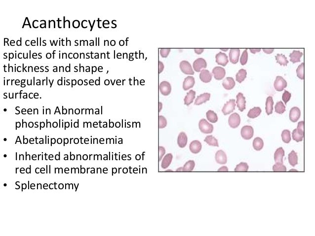 Peripheral blood smear examination