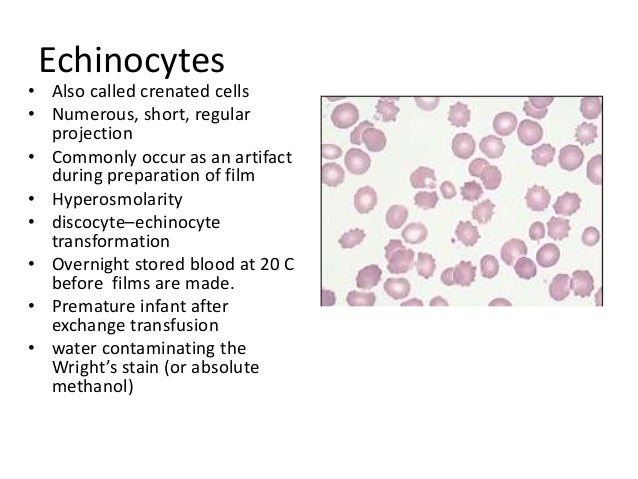 Peripheral blood smear examination