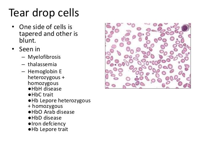 Peripheral blood smear examination