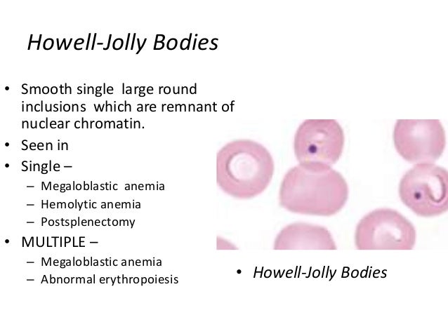 Peripheral blood smear examination