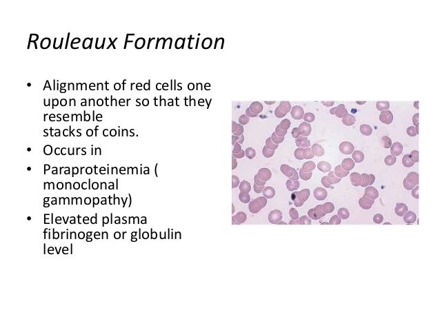 Peripheral blood smear examination