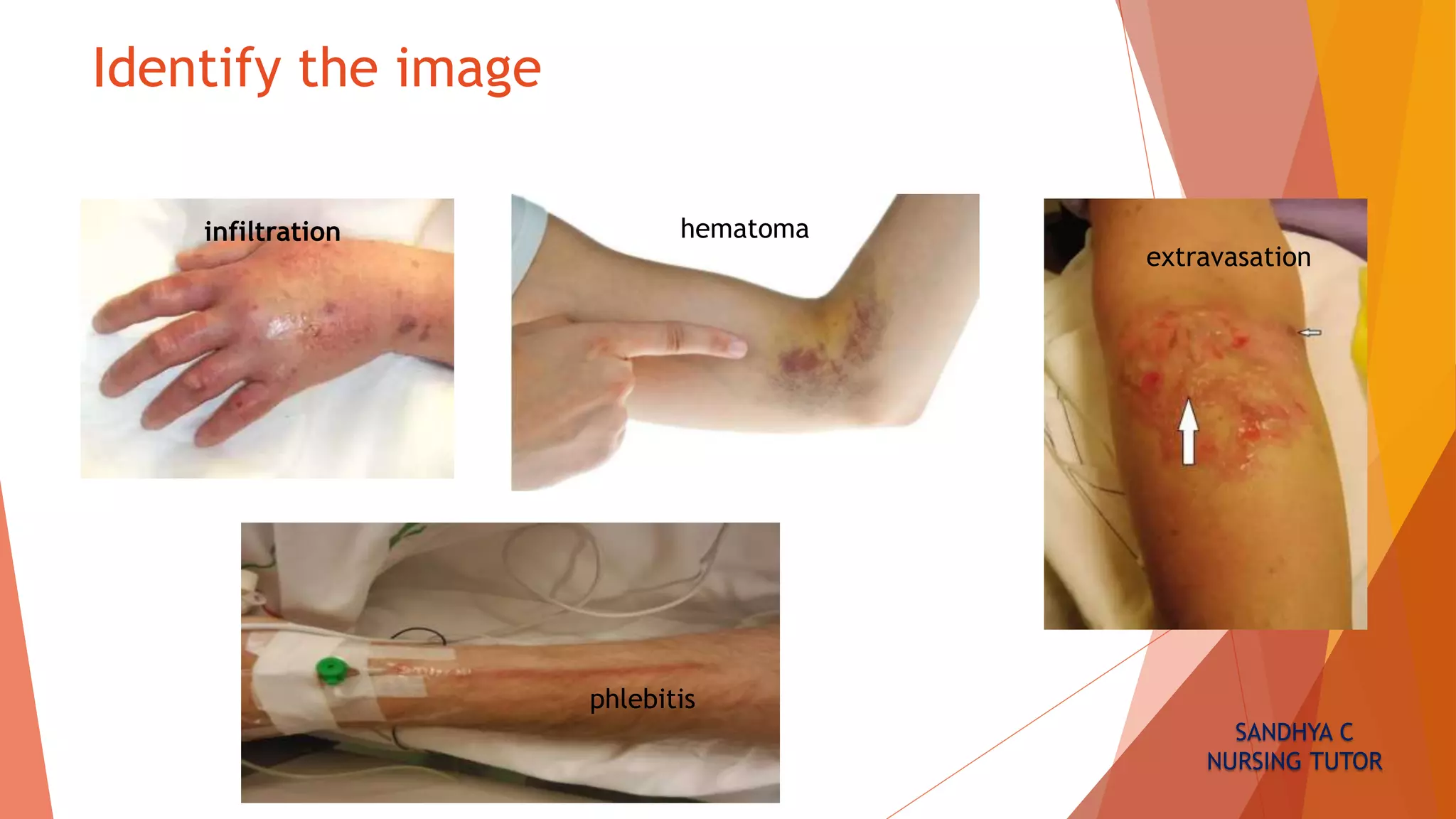 peripheral IV care.pptx