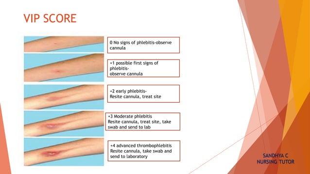 peripheral IV care.pptx | First Aid | Injuries