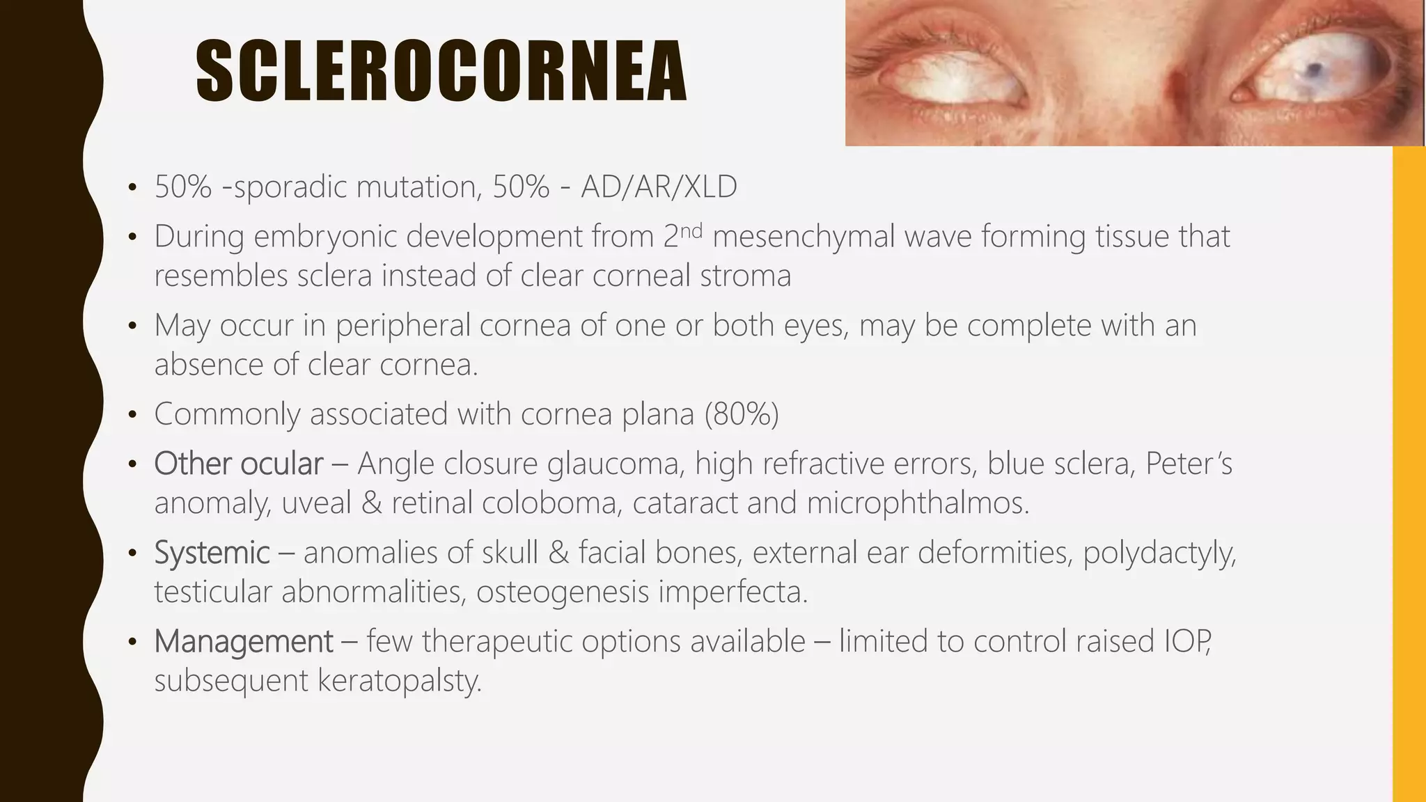 Peripheral corneal diseases | PPTX