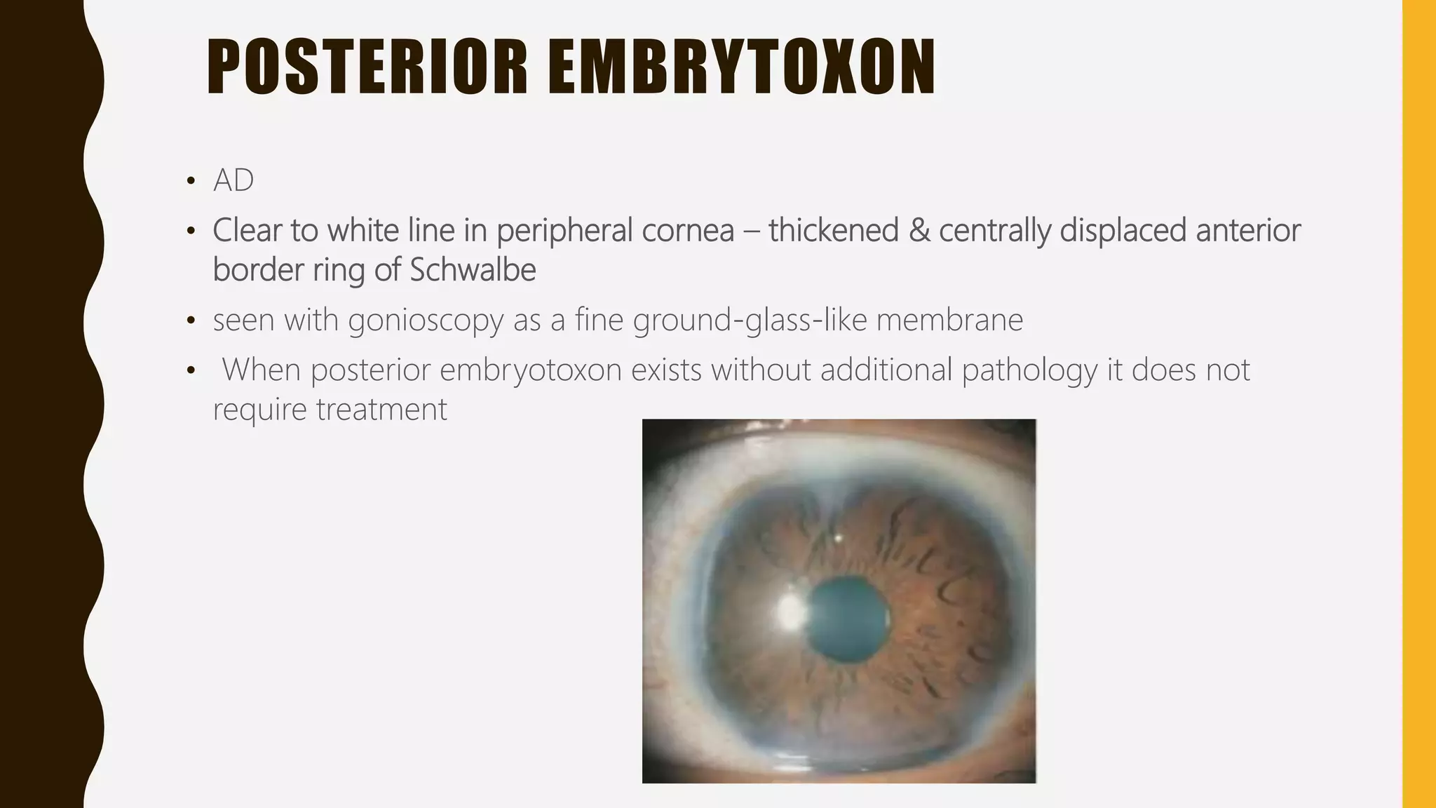 Peripheral corneal diseases | PPTX