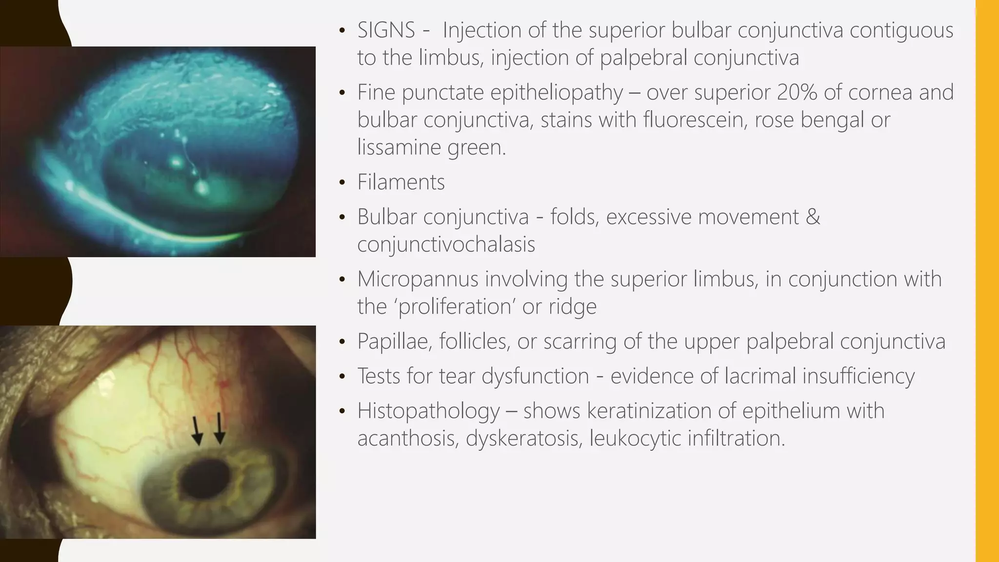 Peripheral corneal diseases | PPTX
