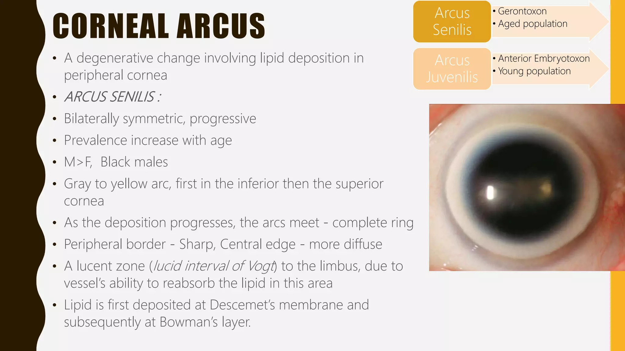Peripheral corneal diseases | PPTX