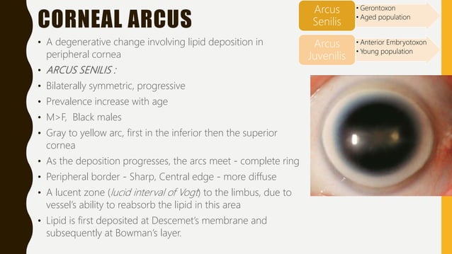 Peripheral corneal diseases | PPTX