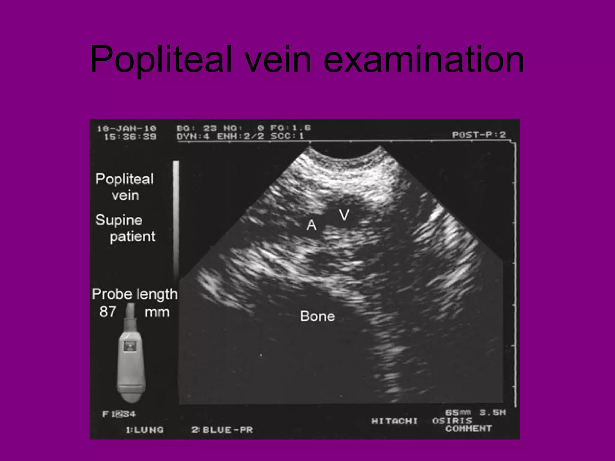 lower limb doppler examination -The essentials | PPT