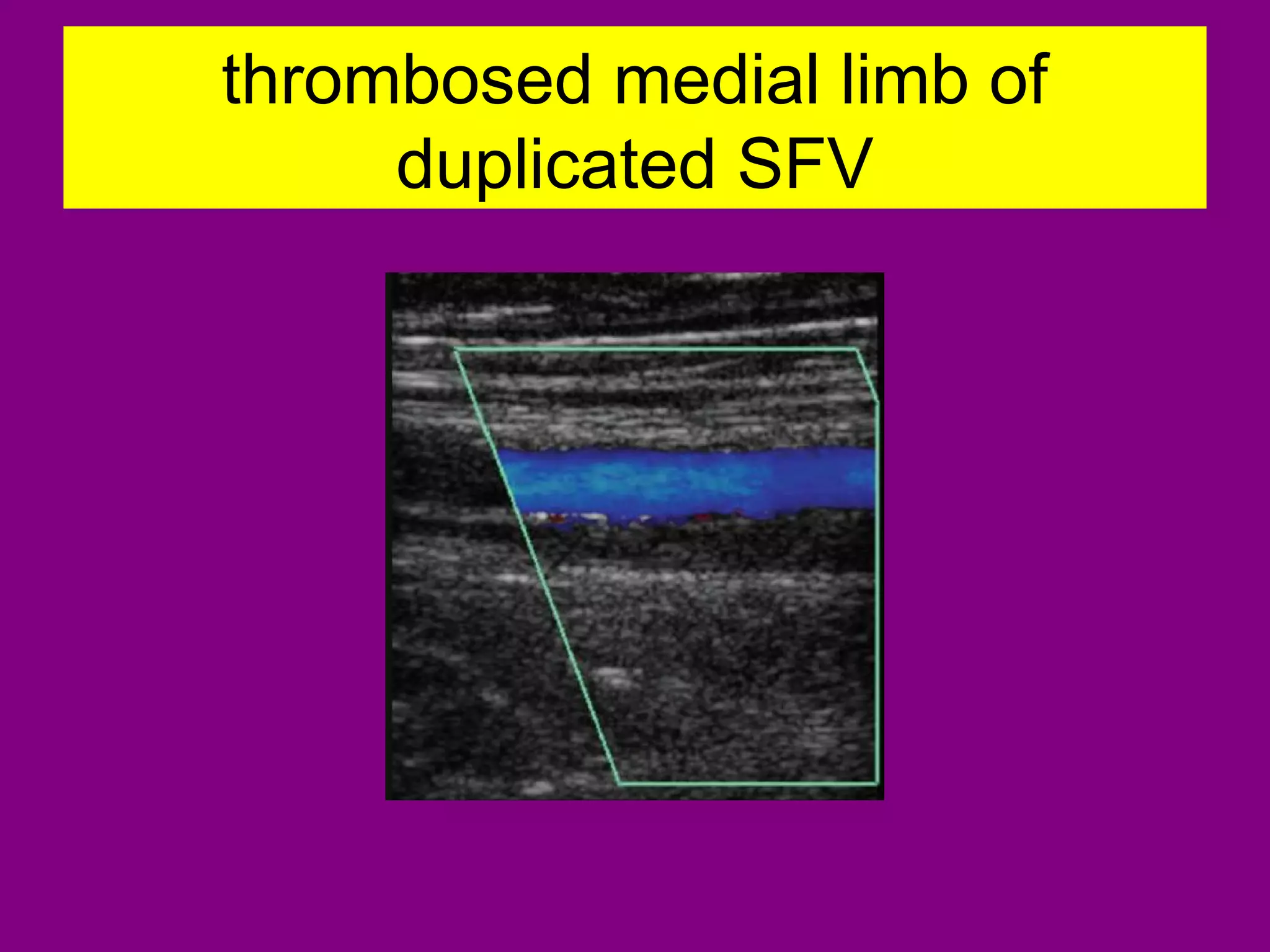 lower limb doppler examination -The essentials | PPT