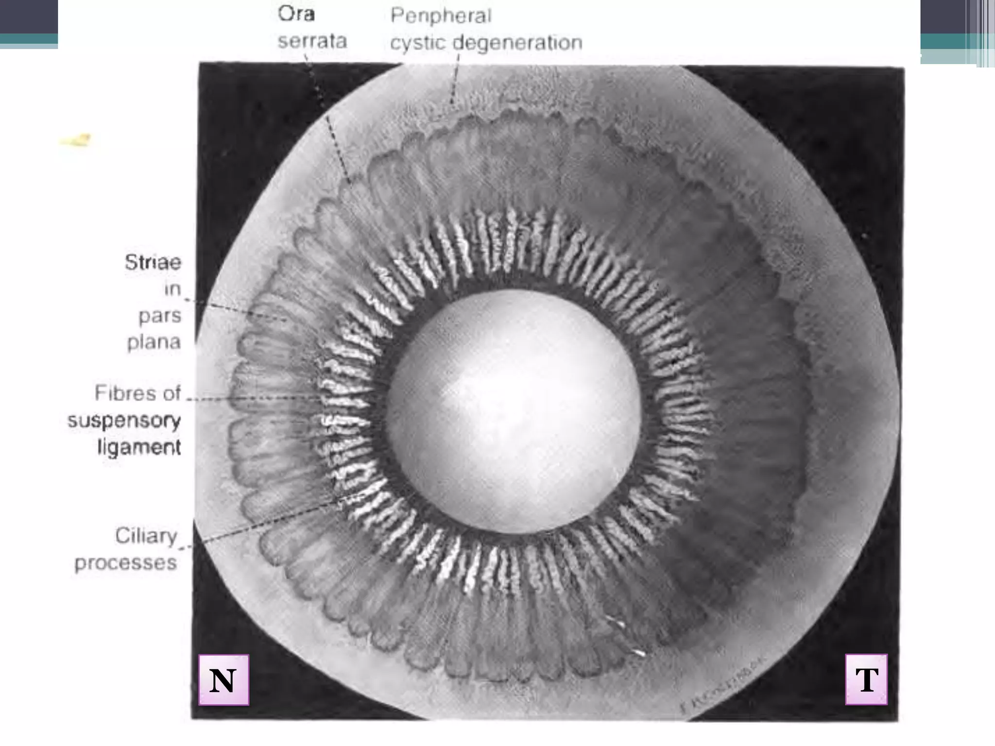 Peripheral fundus & its disorders | PPTX