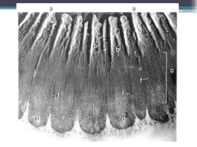 Peripheral fundus & its disorders | PPTX