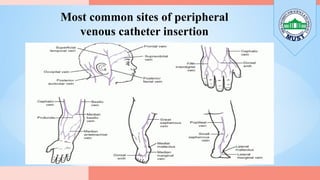 Peripheral intravenous catheter insertion Dr. Zeinab Gamal.pptx