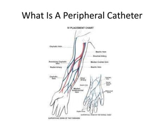 Peripheral iv starts | PPTX