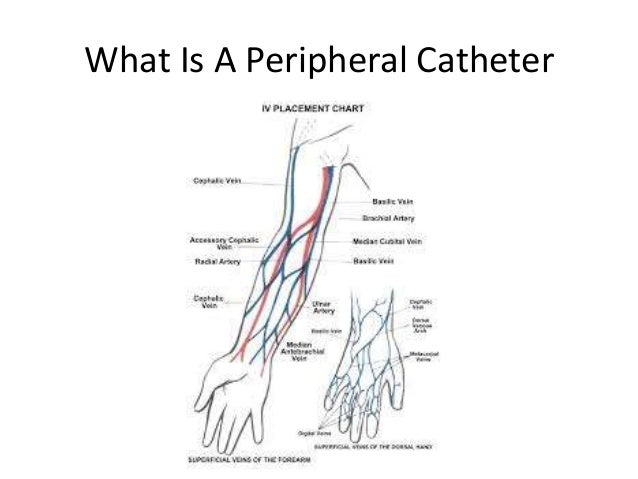 Peripheral iv starts