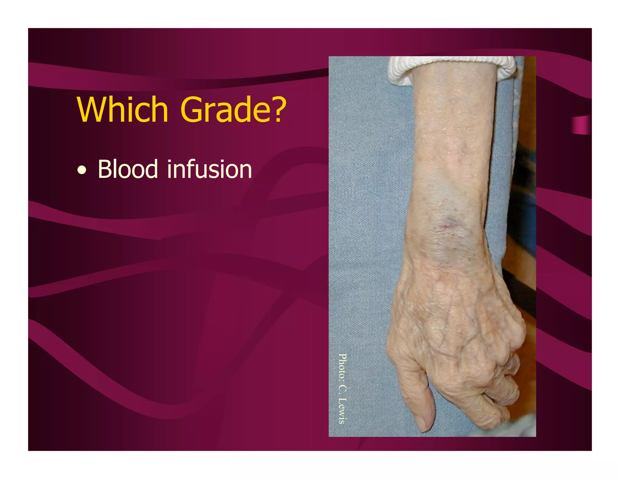 Peripheral IV Therapy | PPT