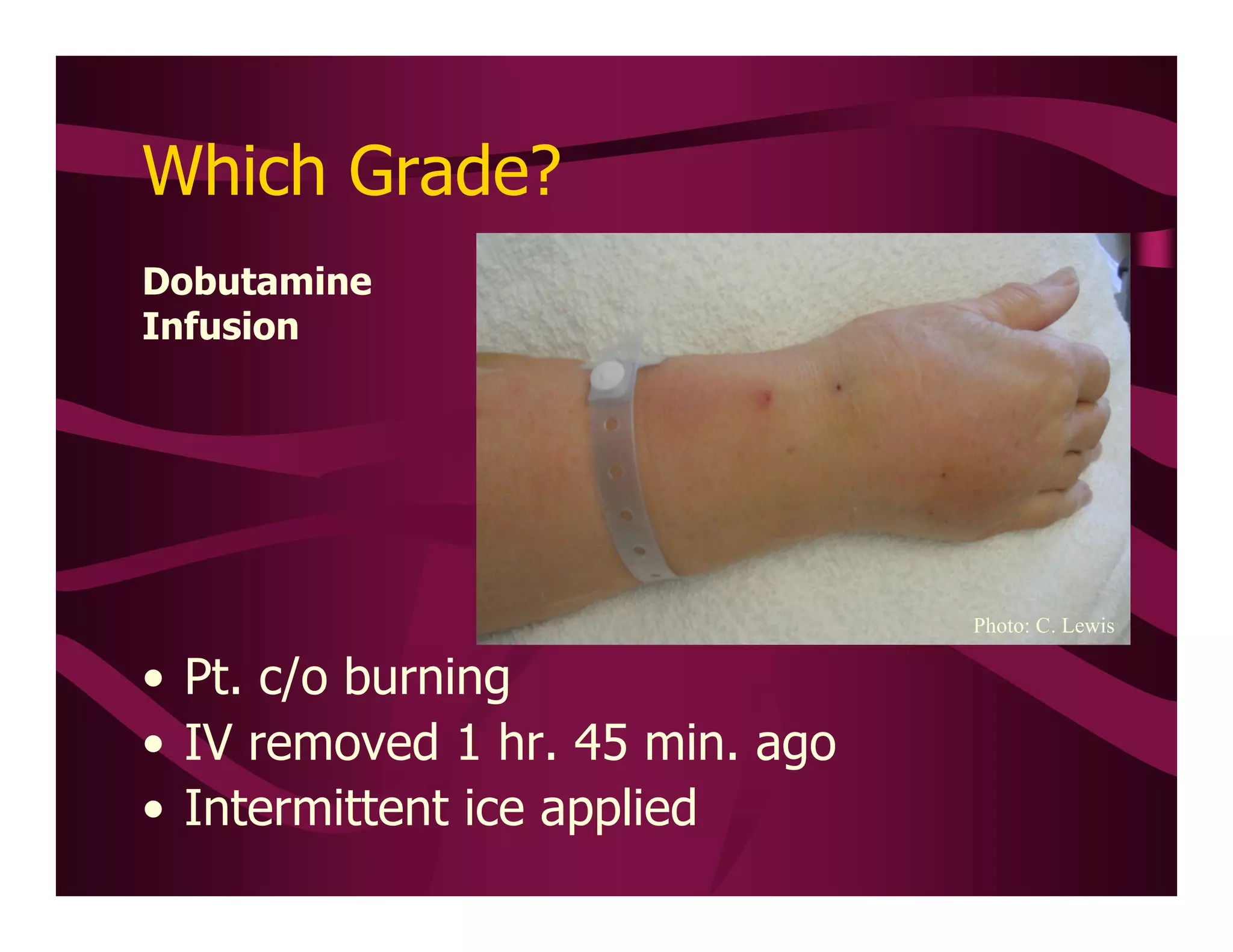 Peripheral IV Therapy | PPT