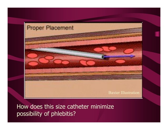 Peripheral IV Therapy | PPT