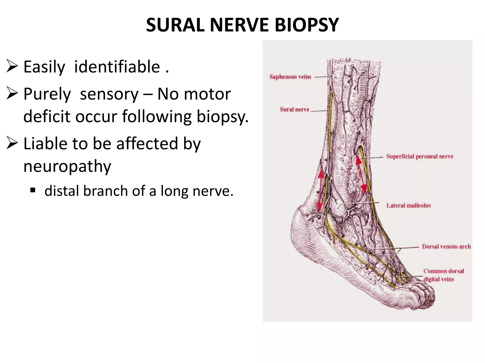 Peripheral nerve biopsy | PPTX